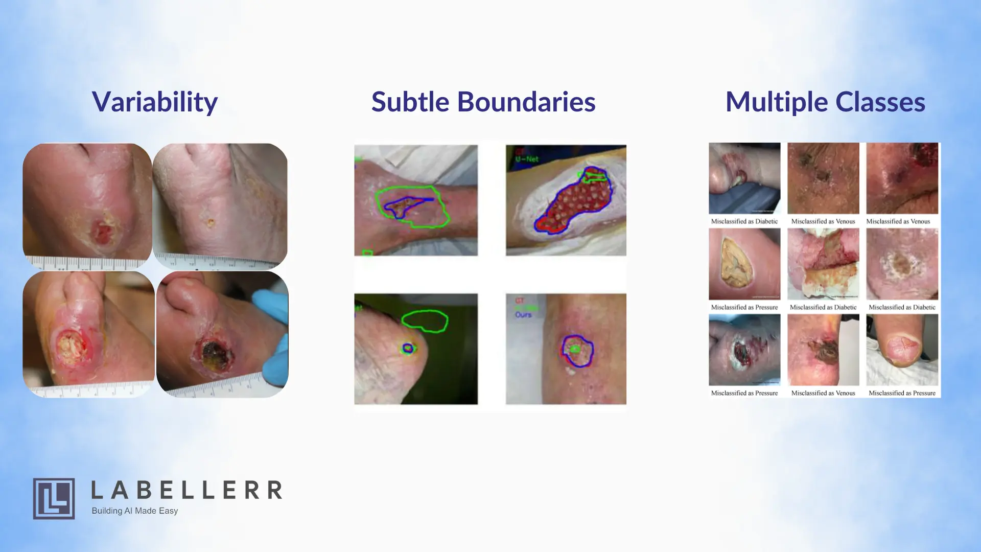 Enhancing Wound Image Segmentation with Labellerr